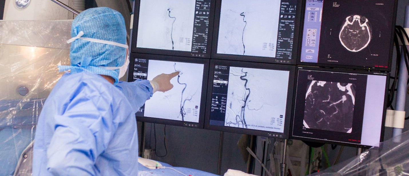 Ангиография сосудов в Москве – Цены, показания, подготовка, процедура ...